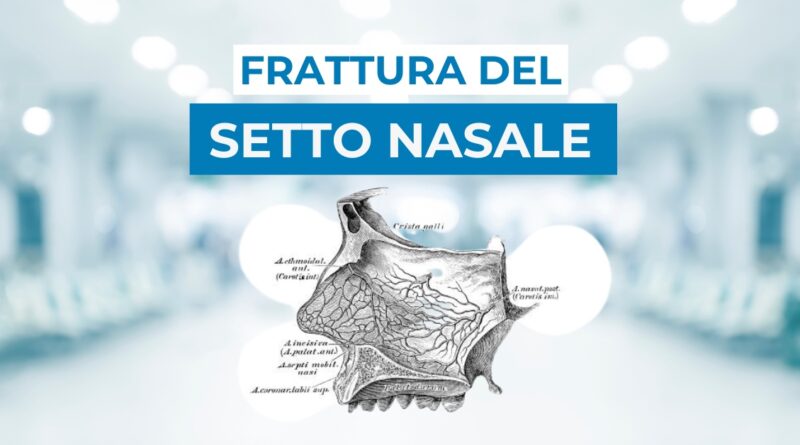 Frattura del setto nasale: cos'è, come curarla, tempi di recupero - EnzoBet